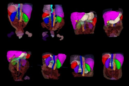 AI and radiologists unite to map the abdomen - Department of Computer ...