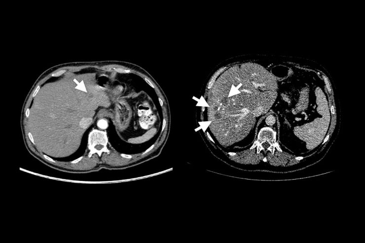 Alan Yuille - Department of Computer Science